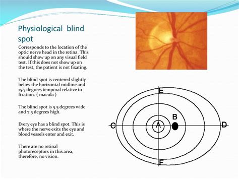 Ppt Visual Field Examinations Powerpoint Presentation Free Download