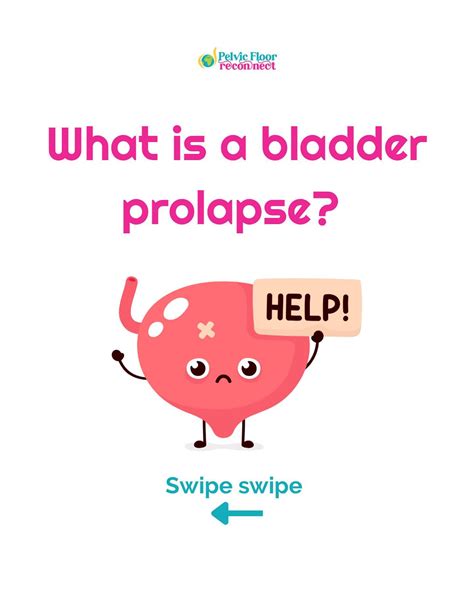 What Is Bladder Prolapse So A Pelvic Floor Reconnect