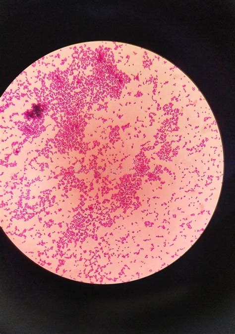Gram Staining Also Called Gram S Method Gram Positive Coccus Stock Image Image Of Illness