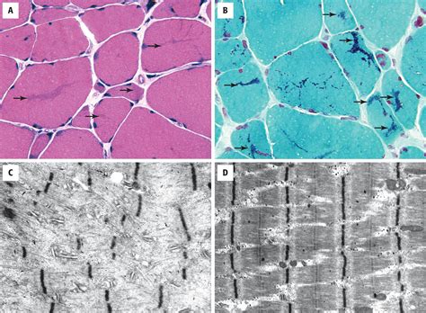 Skeletal Muscle And Peripheral Nerve Disorders Clinical Tree