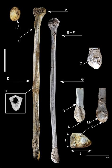 Exploring The Morphology Of Adult Tibia And Fibula From Sima De Los