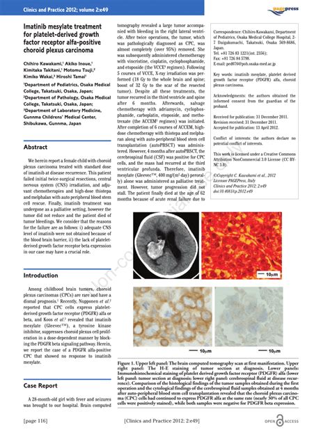 Pdf Imatinib Mesylate Treatment For Platelet Derived Growth Factor Receptor Alfa Positive
