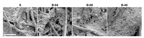 Sem Micrographs Of Ewing Sarcoma Cell Culture Under Static And Flow Download Scientific