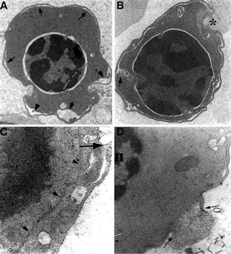 Ultrastructural Characteristics Of Orthochromatic Erythroblasts A Download Scientific