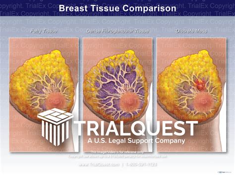 Breast Tissue Comparison
