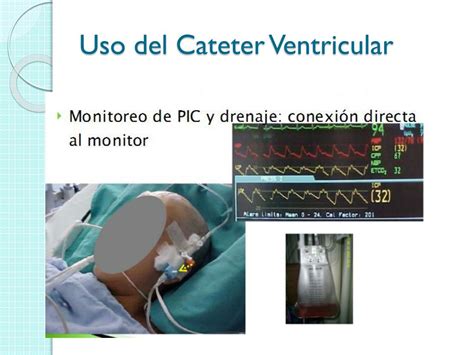 Ppt Lic Esp Marina Vega Lizarme Centro Médico Naval Cmst” Lima