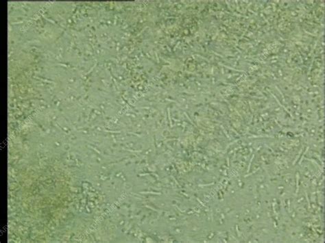 Staphylococcus Bacteria Microscopy Stock Video Clip K0092653