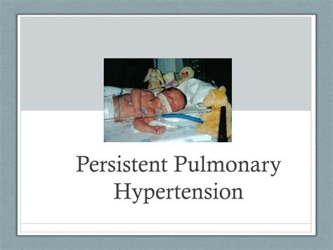 Ppt Persistent Pulmonary Hypertension Powerpoint Presentation Free
