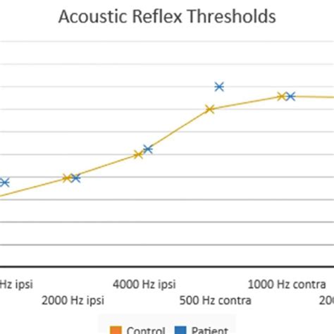 Acoustic Reflex Thresholds Of Groups In The Patient Group The 500 Hz