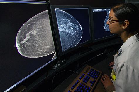 Breast Imaging Expert Explains How New Fda Mammogram Rules Help