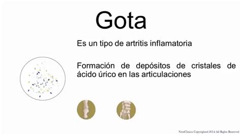 Gout Spanish Youtube