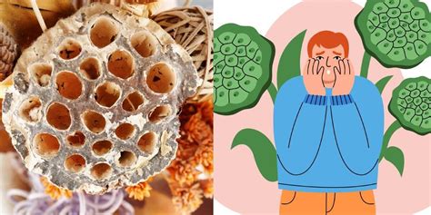 Tripofobia En Niños ¿cuáles Son Sus Causas Y Qué Síntomas Presentan