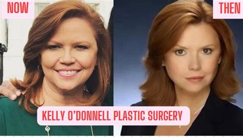 Kelly Odonnell Alleged Plastic Surgery And Weight Loss Facts