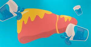 Cuántos Vasos De Agua Puede Beber Al Día Una Persona Con Cirrosis Hepática Y Ascitis Que Sufre