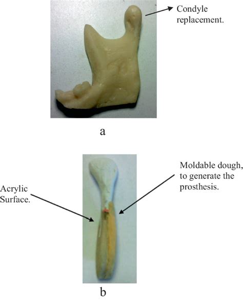Experimental Dynamic Testing For Wear Of Tmj Prosthesis Component In A