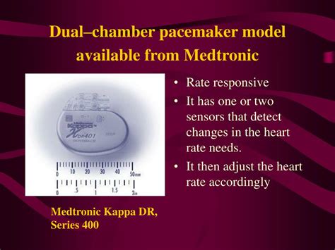 Ppt Cardiac Pacemaker System Powerpoint Presentation Free Download Id 551500
