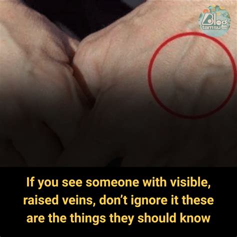 Blog Warn Them As Soon As Possible 😲 Facebook