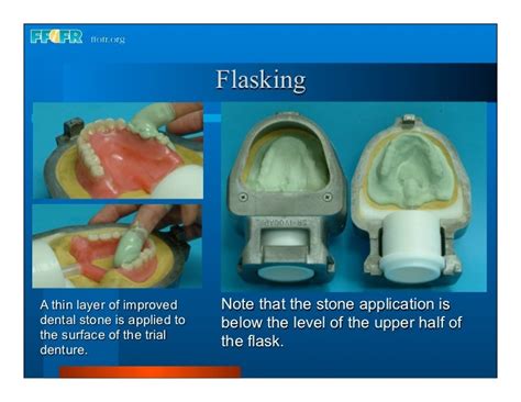 27denture Processing