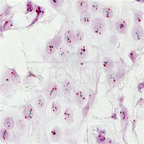 Her2cen 17 Dual Cish Detection Kit Zytovision Technology شرکت سما