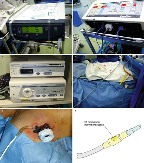 Endoscopic Thyroidectomy Bilateral Axillo Breast Approach Baba