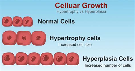 Hypertrophy Hypotrophy Cells