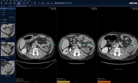 Radiology Imaging Sectra Medical