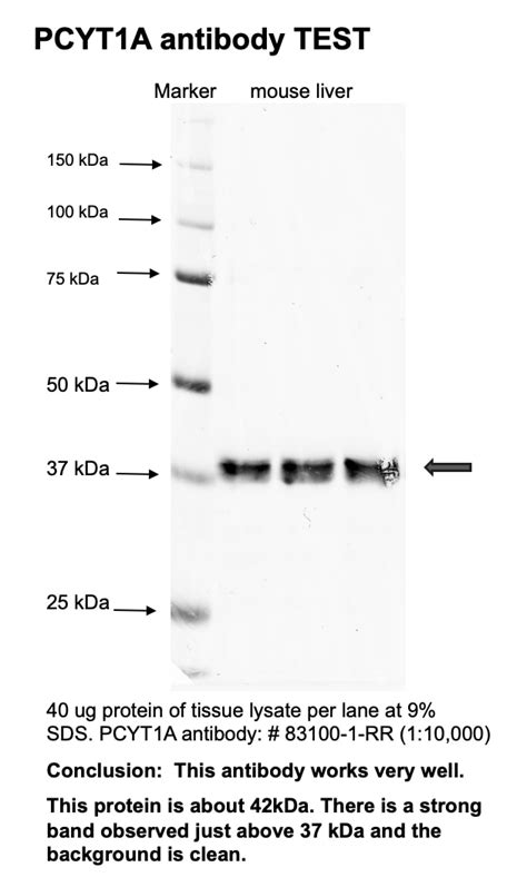 Pcyt1a Antibody 83100 1 Rr Proteintech