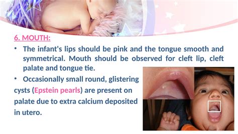 Assessment Of Newborn And Daily Assessment Pptx
