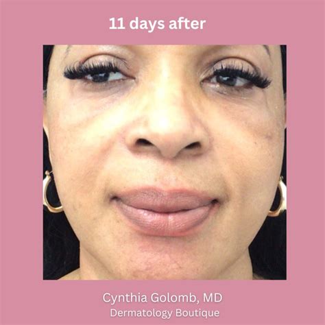 Festoons Und Malar Bags At Patricia Bartholomew Blog