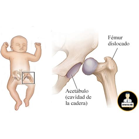 Dr Israel Localización Principal De Los Aneurismas Cerebrales 🧠💉🚑