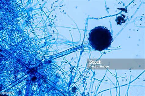 Aspergillus Niger And Aspergillus Oryzae Under Microscope For