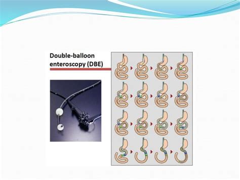 Approach To Occult Bleeding Pptx Blood Disorders Diseases And
