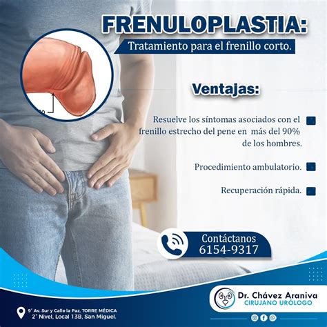 Que Es Frenuloplastia Tratamientos Complementarios Rinoplastia