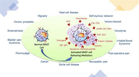 Mast Cell Activation Syndrome Mcas Perth Allergy Clinic