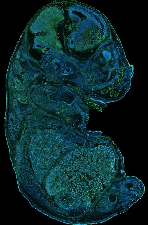 Mouse Embryo Section E15 5 Labeled With E Cadherin Antibody Bicell Blue