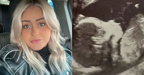 El Increíble Caso De Shannon Webster La Mujer Con Dos úteros Que Llevó