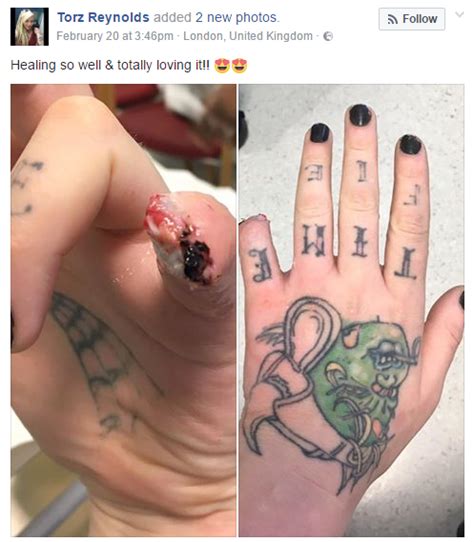 Torz Reynolds The Girl Who Cut Off Her Finger Of The Day