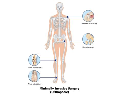 Minimally Invasive Surgery Mis Columbia Asia Hospital I Private