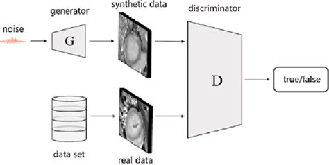 Figure 1 From Evolutionary Ganbased Data Augmentation For Cardiac Magnetic Resonance Image