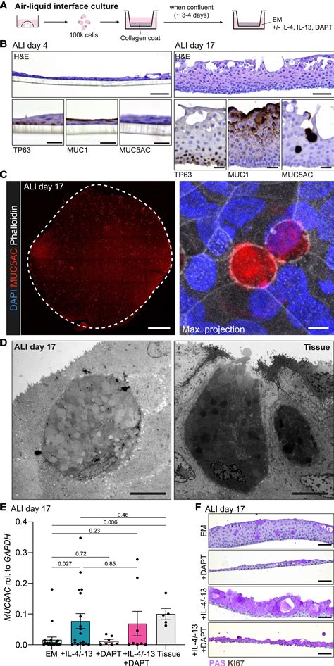 Human Conjunctiva Organoids To Study Ocular Surface Homeostasis And