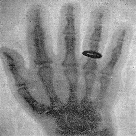 First X Ray Machine Roentgen