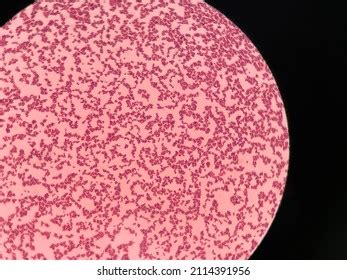 Coccus Bacteria 400x
