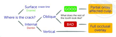 Decision Map For Cracked Teeth Download Scientific Diagram