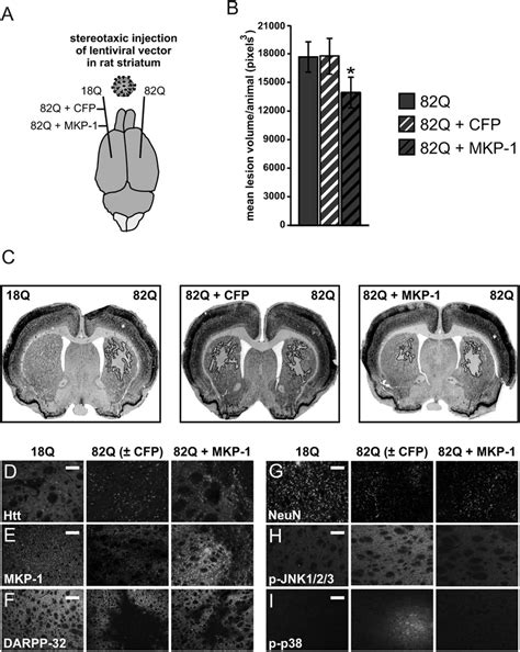 Mkp 1 Overexpression Is Neuroprotective In An In Vivo Model Of Hd A