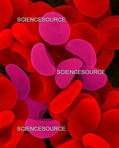 Red Blood Cells In Hypotonic Solution Stock Image Science Source