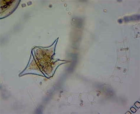 Protoperidinium Oblongum