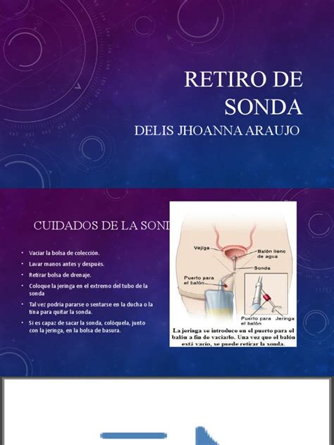 Guía Para Retiro De Sonda Médica Pdf