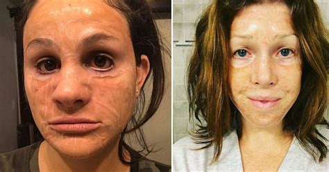 This Terrifying Hanacure Mask Is The Key To A Fresh Face