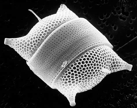 Diatom Electron Microscope