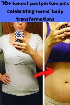 70 Honest Postpartum Pics Celebrating Moms Body Transformations Artofit